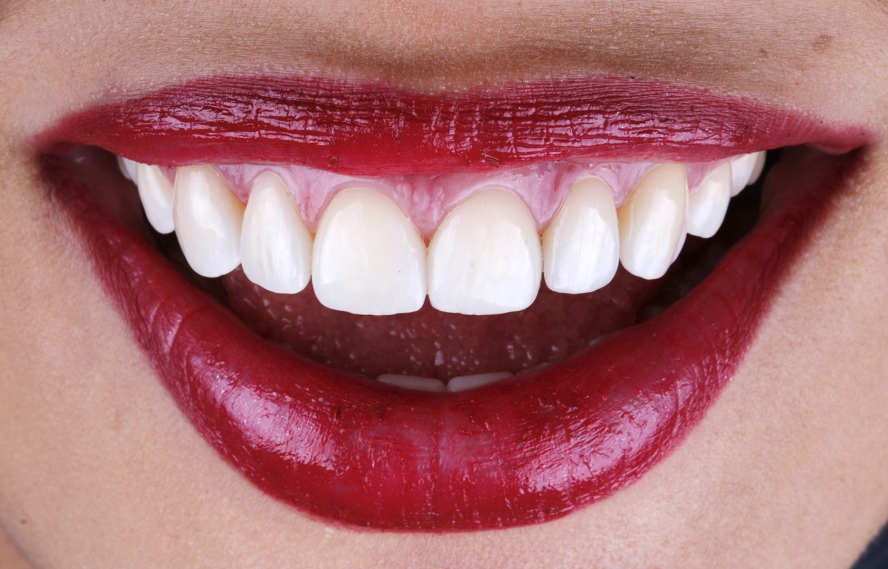 Smile Design | Adrián Sáenz Dental